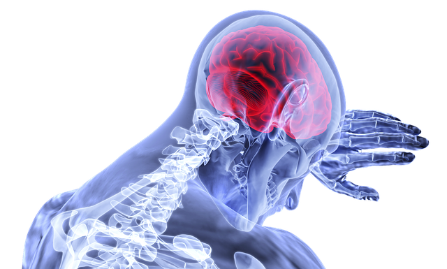 Miracle Minute! A patient with mobility issues to due to stroke ...